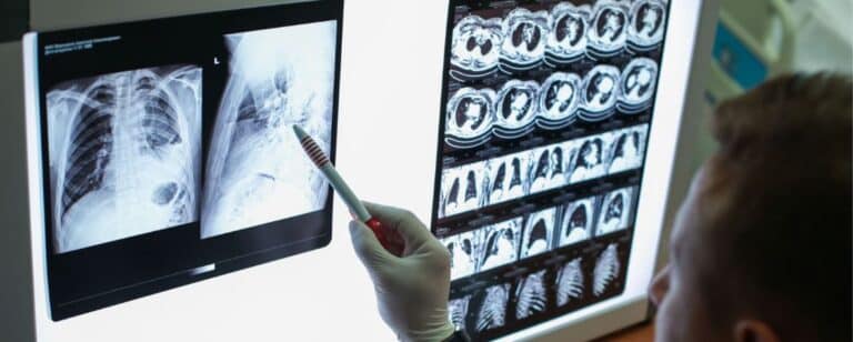 TAC de tórax con contraste: procedimiento y ventajas - ImatecSalud